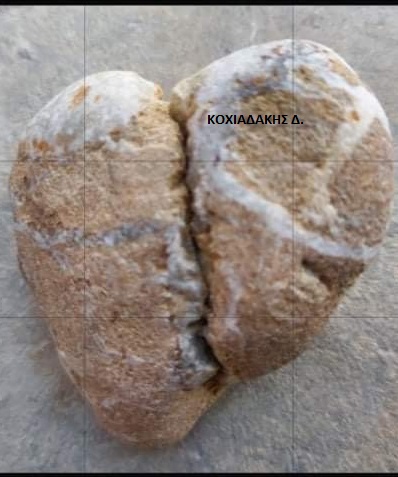 ΠΡΟΧΩΡΗΜΕΝΗ ΚΑΡΔΙΑΚΗ ΑΝΕΠΑΡΚΕΙΑ ΕΠΙΔΗΜΙΟΛΟΓΙΑ, ΔΙΑΓΝΩΣΗ ΚΑΙ ΘΕΡΑΠΕΥΤΙΚΗ ...