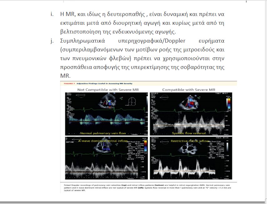 Βασικές αρχές στην ηχωκαρδιογραφική αξιολόγηση της ανεπάρκειας της ...
