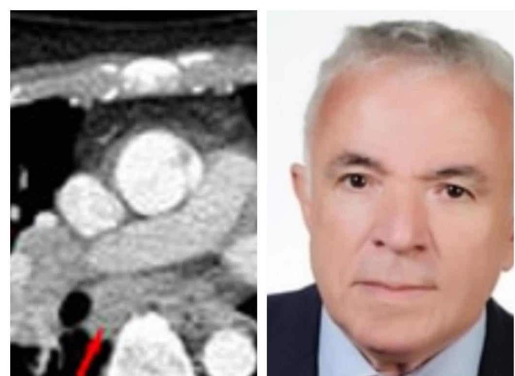 ΕΠΙΣΤΗΜΟΝΙΚΑ ΚΙ … ΑΛΛΑ”από τον Ομ. Καθηγητή, Ιωάννη Γουδέβενο, 20.12. ...